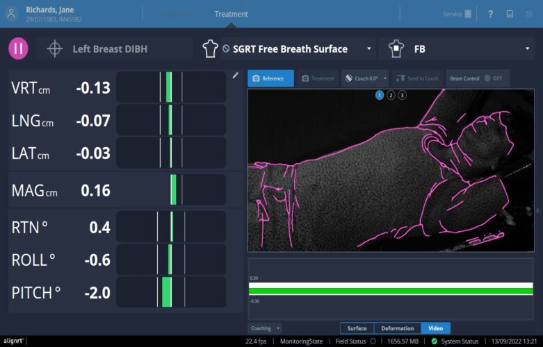 SGRT: It's about TIME event - Vision RT