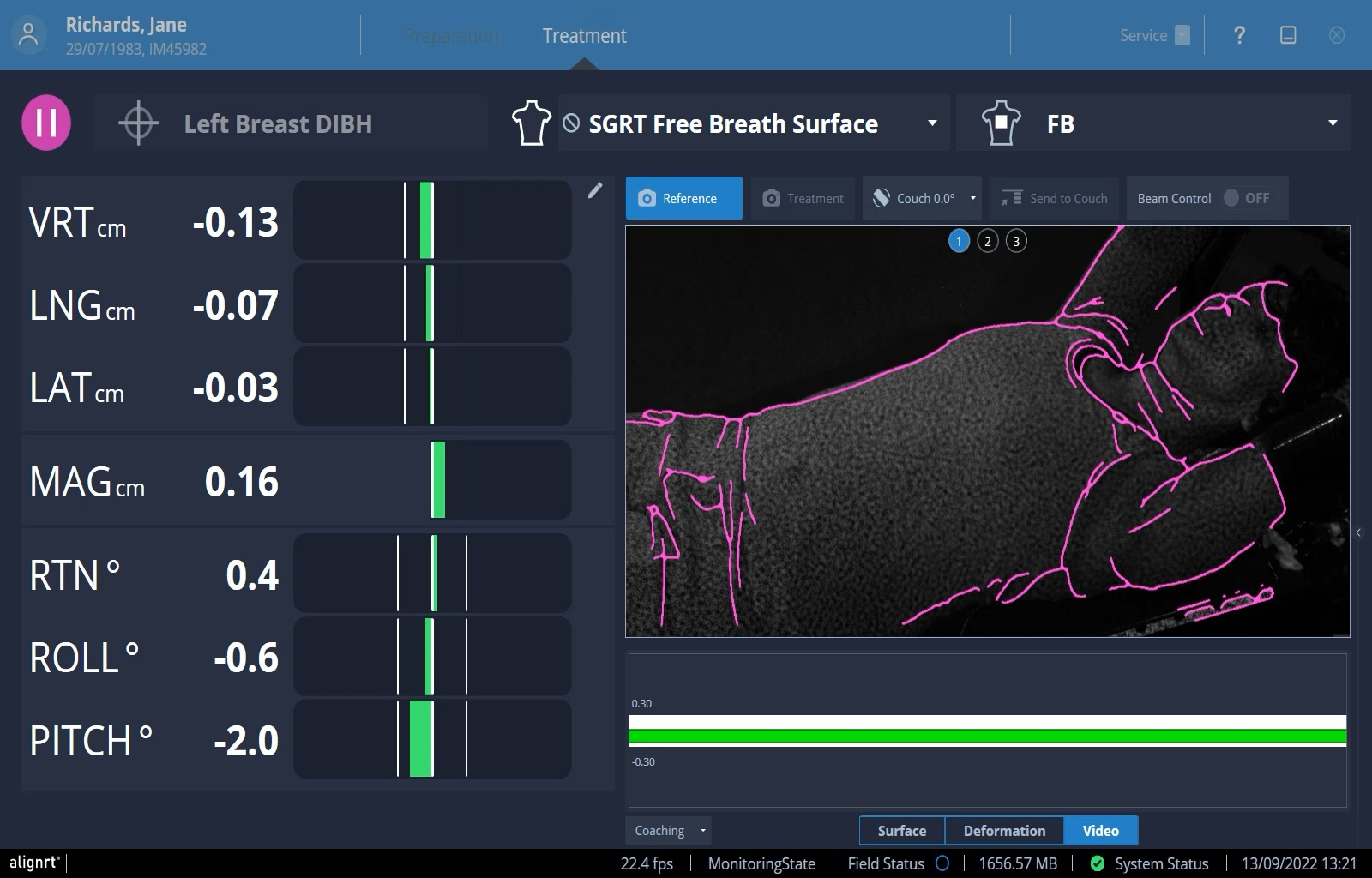 Postural Video | Clear Positional Guidance