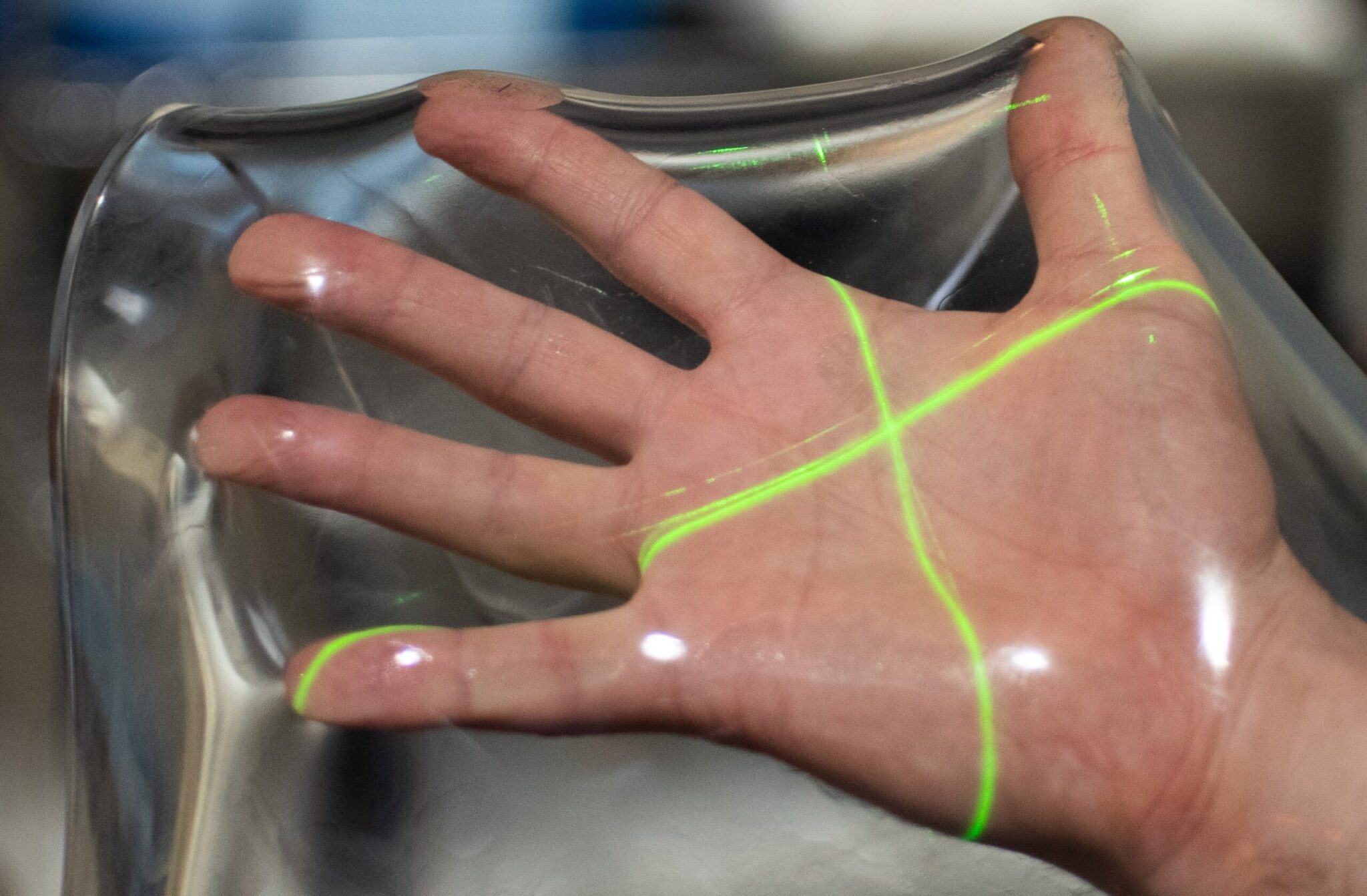 Vision RT Compatible | Radiotherapy Accessories With AlignRT