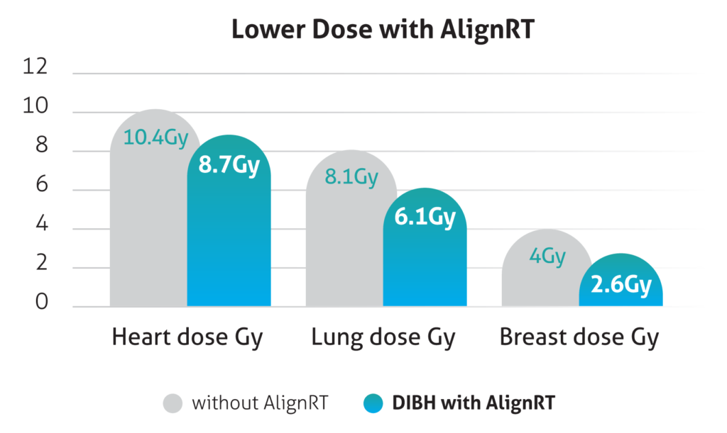 AlignRT & DIBH for Reduced Radiation Toxicity - Vision RT
