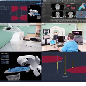 Vision RT Solutions | SGRT Technology for Radiation Therapy