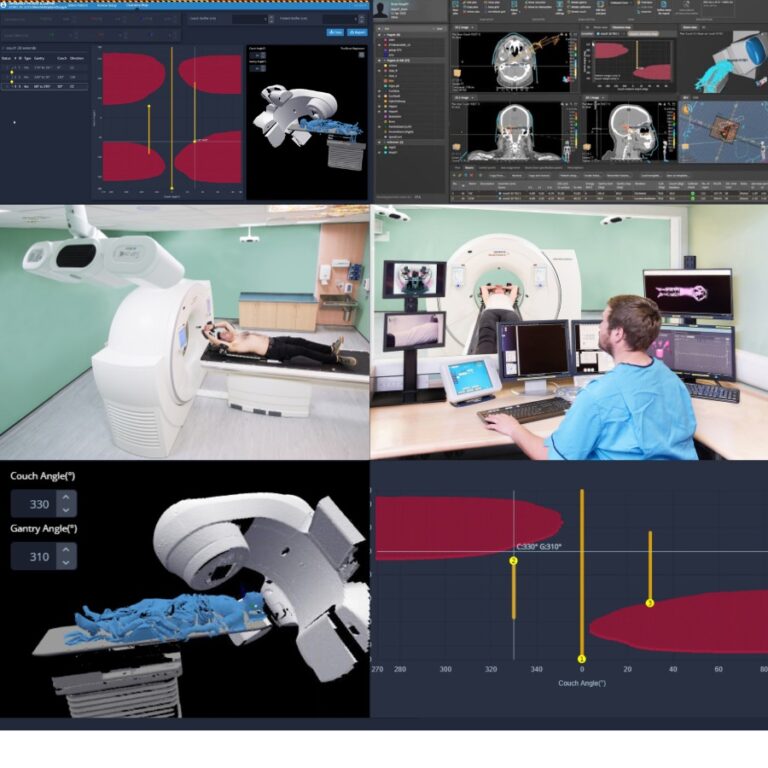 Vision RT Solutions | SGRT Technology for Radiation Therapy