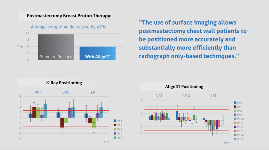 AlignRT for Proton Therapy | Precise & Efficient