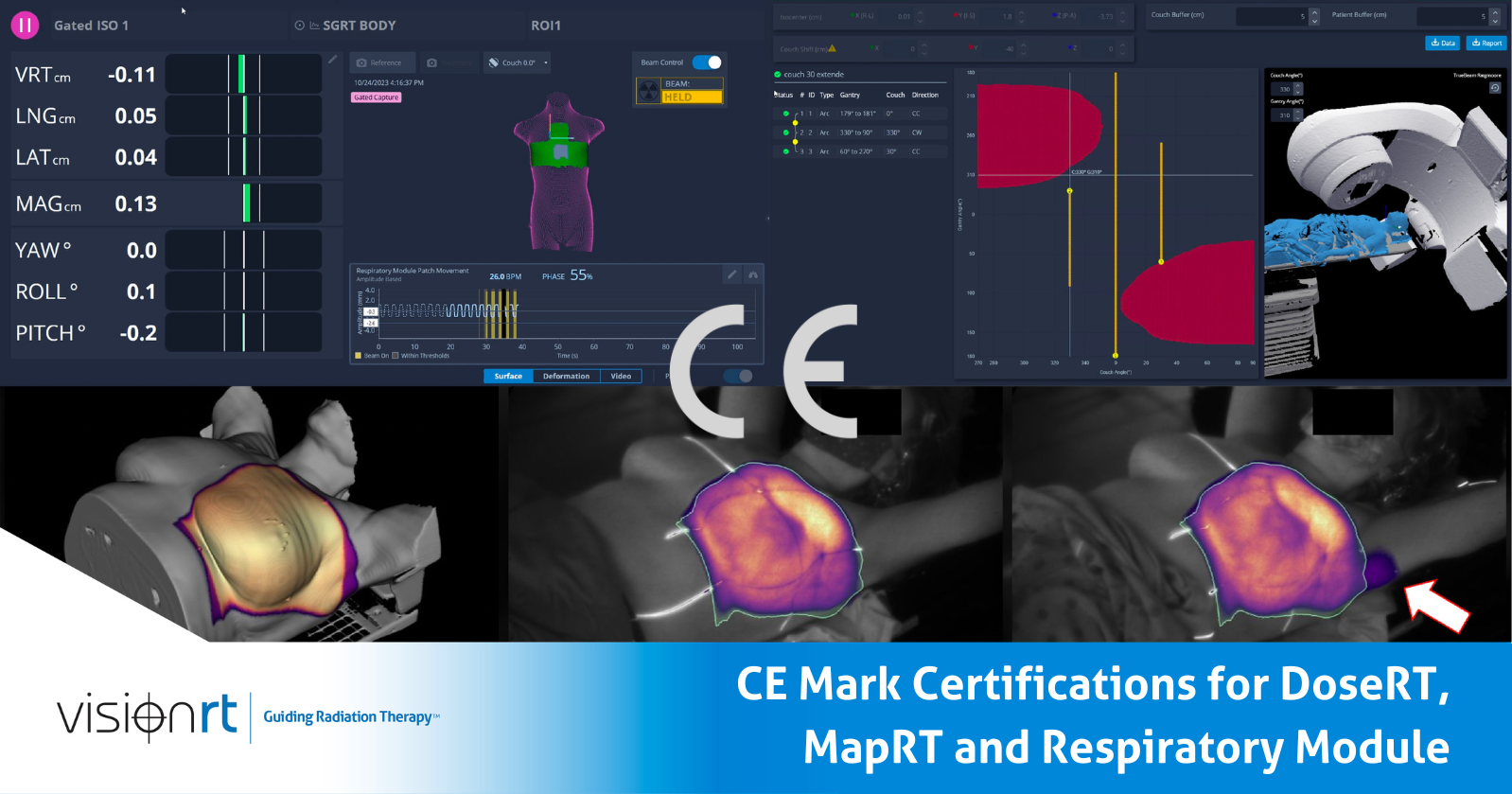 CE Mark Certifications for DoseRT, MapRT and Respiratory Module - Vision RT