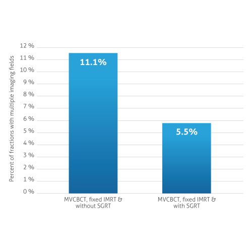 AlignRT InBore | Dedicated SGRT Solution for bore based linacs